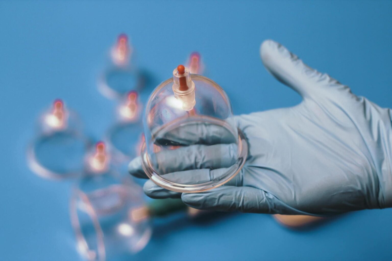 What is Hijama Cupping Therapy Benefits | Amerihijama Center